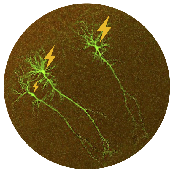 Dr Mathias De Roo – NEUROPROTECT